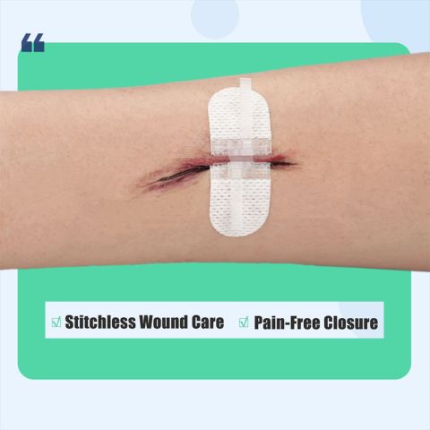 SmartKit® Zip Stitch Laceration Wound Closure Kit - 31 pcs